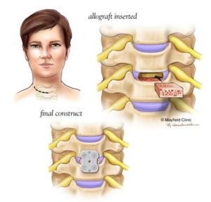 Depicting Reconstructive Surgery – Artists' Blogs :: Medical ...